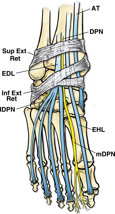 Left First Extensor Compartment Release At Olga Johnsen Blog