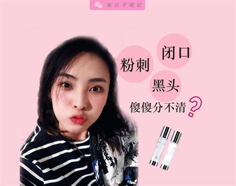 粉刺、闭口、黑头、痤疮！你还傻傻分不清！ 知乎