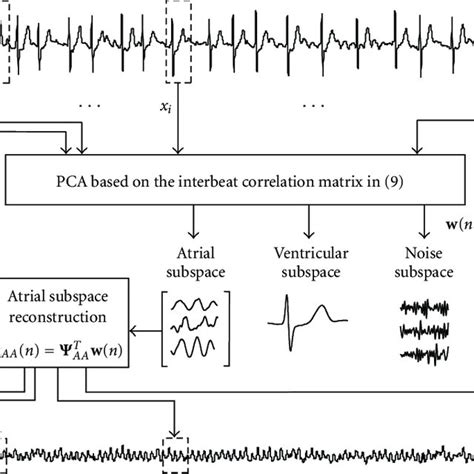 Pdf Principal Component Analysis In Ecg Signal Processing