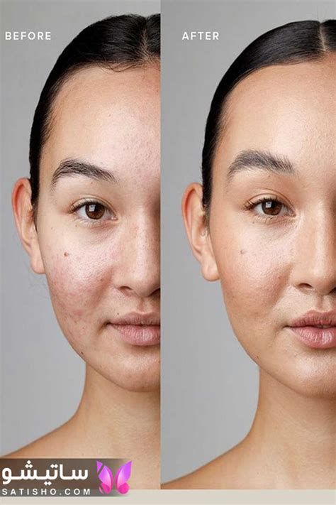 تینت پوست چیست و چه فرقی با کرم پودر دارد؟ ساتیشو