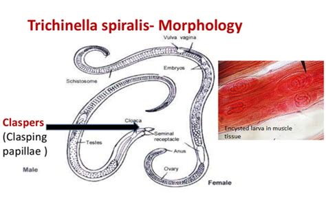 Trichinella Spiralis Morphology