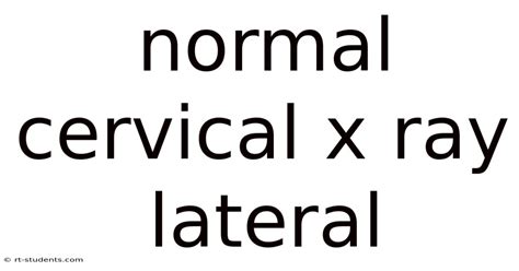 Normal Cervical X Ray Lateral