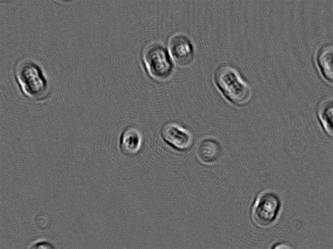 Bacterial Only Image Dataset Abha Gejji Workspace Object Detection