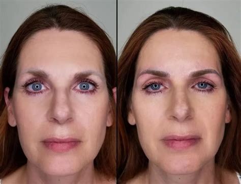 Ombre Brows Vs Microblading Which Technique Is Right For You