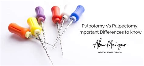 Difference Between Pulpotomy And Pulpectomy Your Full Guide Abumaizar Dental Roots Clinic