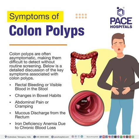 Colon Polyps Definition Risk Factors Symptoms Of Colon Colon Cancer