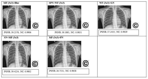 Image Watermarking Using Discrete Wavelet Transform And Singular Value