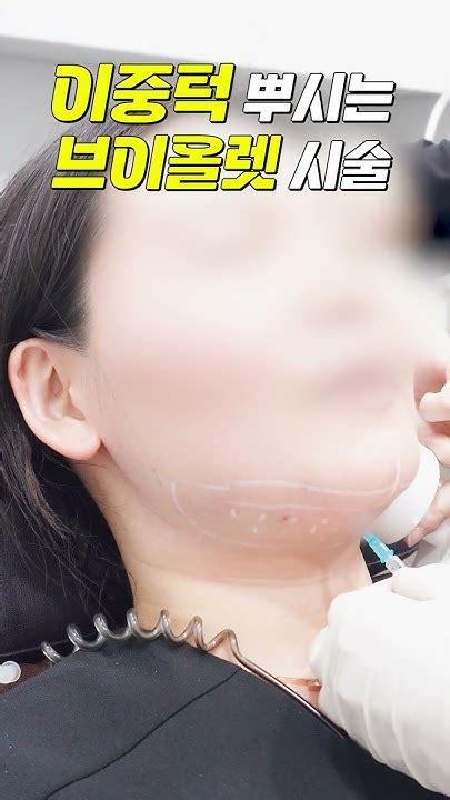 이중턱 없애는 브이올렛 주사 후기 Shorts브이올렛 지방분해주사 Youtube