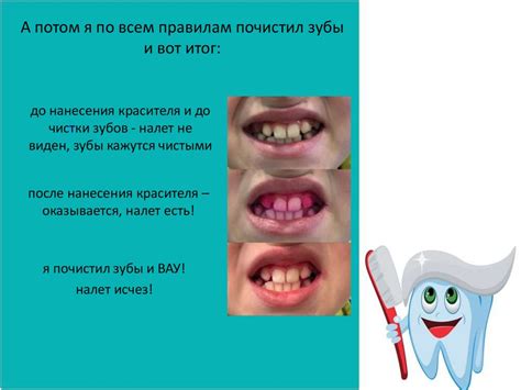 Гигиена полости рта - презентация онлайн