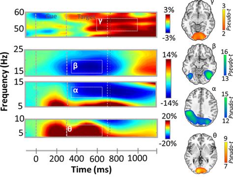 High‐definition Transcranial Direct Current Stimulation Of The Occipital Cortices Induces