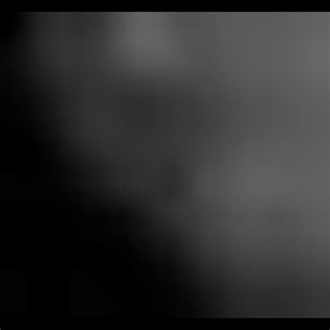 Citrus Ecoli Classification Dataset And Pre Trained Model By Snehits V2