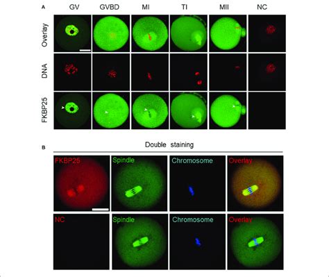 Cellular Localization Of Fkbp25 In Mouse Oocyte A Freshly Download Scientific Diagram
