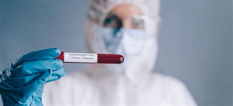 Negative Coronavirus Test Result Stock Image Image Of Diagnostic