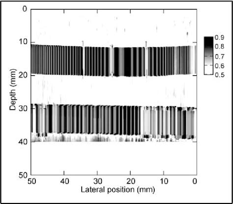 Figure 1 From Small Calculus Detection For Medical Acoustic Imaging Using Cross Correlation
