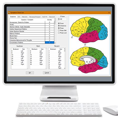 Applied Neuroscience Inc Most Affordable Eeg And Qeeg Analysis And