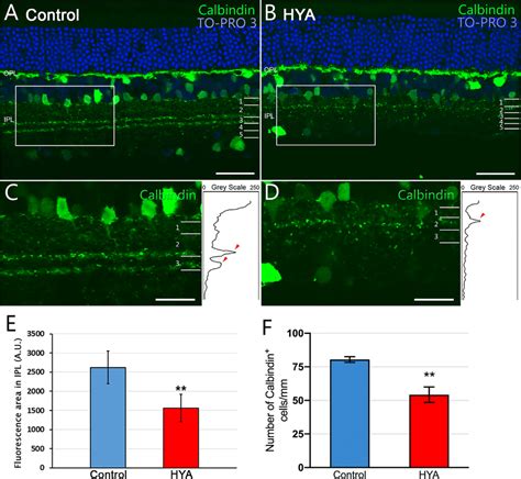 Characterization Of The Inner Plexiform Layer Sublaminae Immunostained Download Scientific