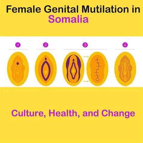 Female Genital Mutilation In Somalia Culturea And Health 2025