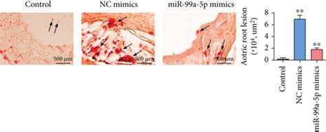 Increased Expression Of Mir 99a 5p Could Alleviate Atherosclerotic