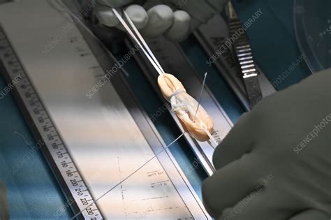 Acl Graft Preparation Stock Image C057 4739 Science Photo Library
