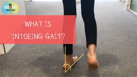 Intoeing Gait And Orthotics Therapy YouTube