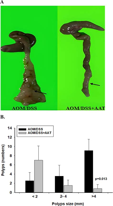 A And B Aat Therapy Lowers Tumor Numbers A Representative Colons