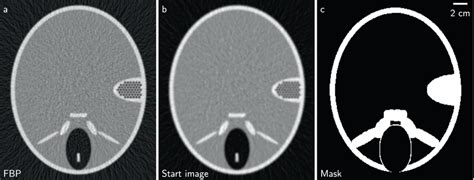 A Filtered Backprojection Fbp B Start Image For The Iterative Download Scientific