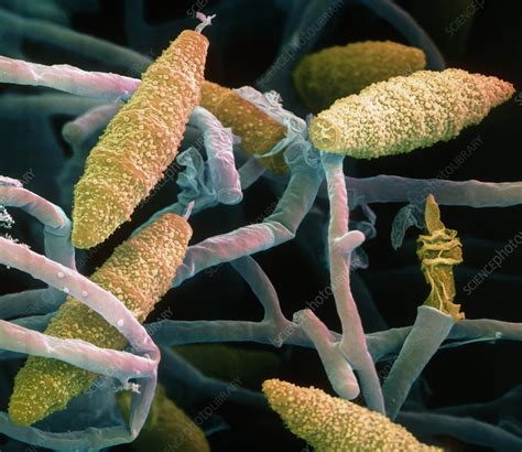 Ringworm Under Microscope