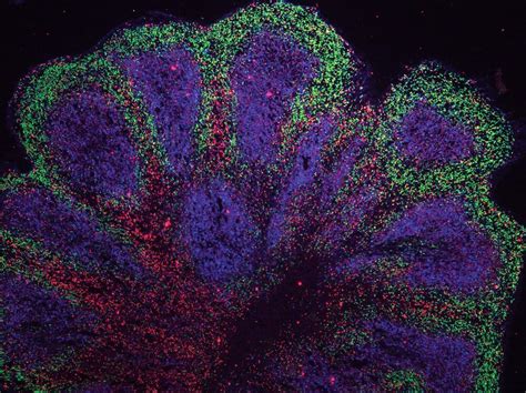 Scientists Grow “mini Brains” In The Lab — Find Potential Treatment Path For Fatal Neurological