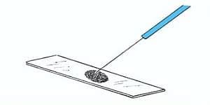 Negative Staining Principle Protocol And Result Interpretation BIOCHEMINSIDER