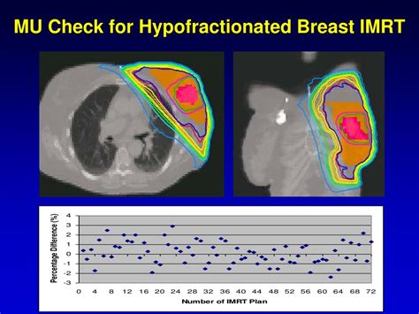 Ppt Independent Dose Verification For Imrt Using Monte Carlo Powerpoint Presentation Id 4159165