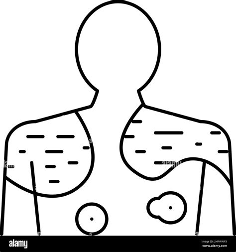 Psoriasis Disease Line Icon Vector Illustration Stock Vector Image