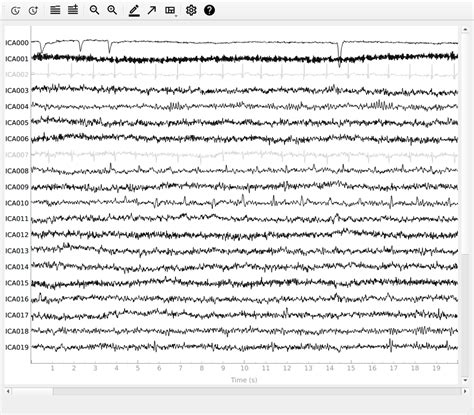 Repairing Artifacts With Ica — Mne 1102 Documentation