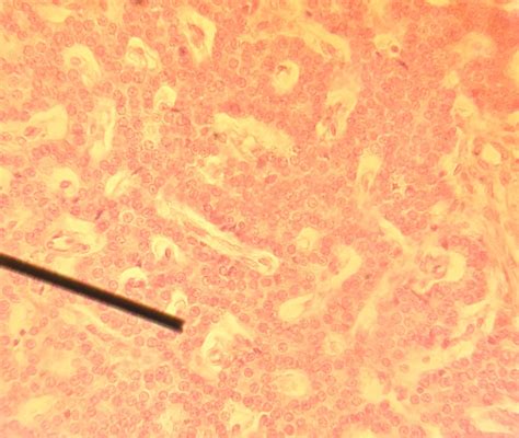 Parathyroid Anatomy Midterm Study Guide Diagram Quizlet