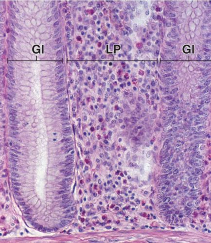 9 Lymphatic Written Flashcards Quizlet