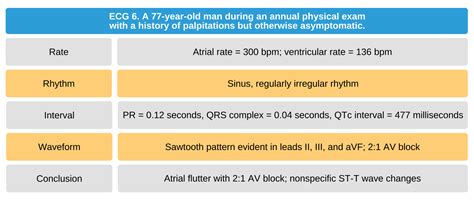 Topic Atrial Flutter 12 Lead Ecg Course Acls Certification