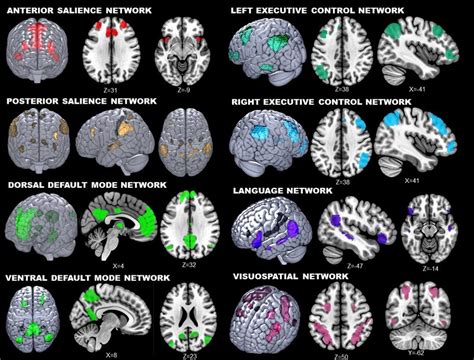 Spatial Maps Of The Eight Resting State Networks Analyzed In This