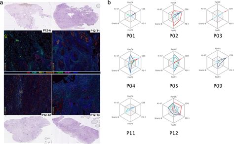 Tumor Immune Microenvironment Profiling With Fluorescent Multiplex Download Scientific Diagram