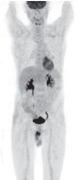 NM Name The Scan Flashcards Memorang