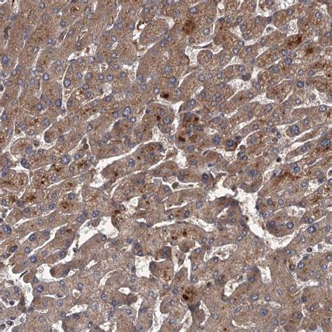 Rabbit Polyclonal Anti Unc93b1 Antibody Buy For Research Highly Specific Rigorously