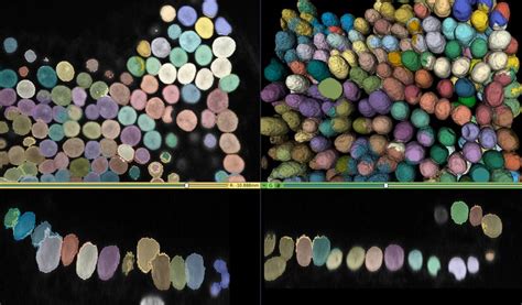 3d Confocal Imaging And Segmentation Of 3d Cells The Top Right Panel