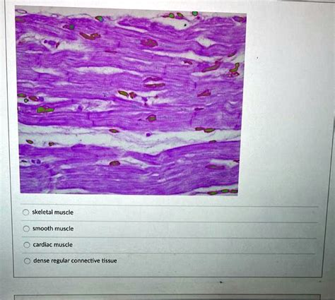 Solved Need Help Defining This Image Skeletal Muscle Smooth Muscle