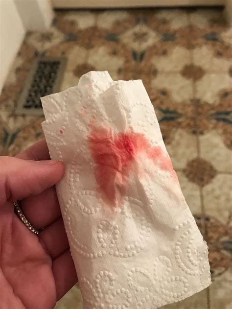 What Does Implantation Bleeding Look Like On A Pad