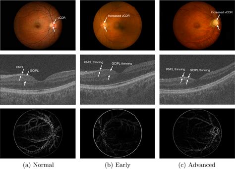论文审查 Etscl An Evidence Theory Based Supervised Contrastive Learning