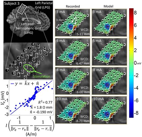 Frontiers Artifact Propagation In Subdural Cortical Electrostimulation Characterization And