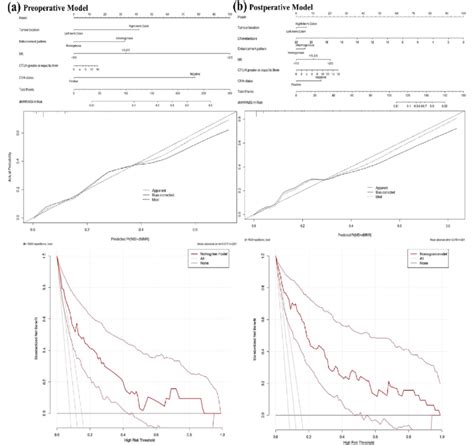 A Preoperative Model Nomogram Calibration Plot And Dca B