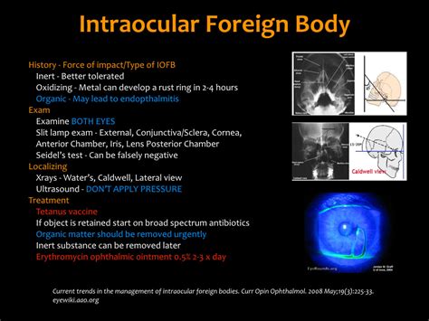 Intraocular Foreign Body Advancing Rural Emergency Medicine