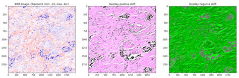 Application Of Icc Profiles To Digital Pathology Images Andrew Janowczyk