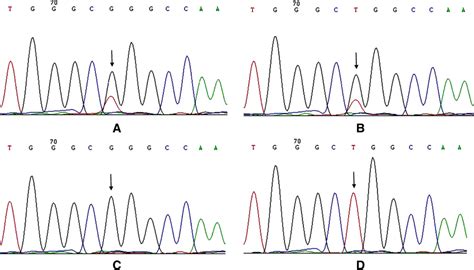 Representative Sequencing Picture For Egfr Exon 21 From Single H1975