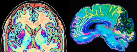 Python In Medical Imaging An Roi Extraction Example By León Andrés M
