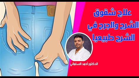 علاج شقوق الشرج والجرح في الشرج الحكة الشرجية أسبابها وعلاجها منزلياً